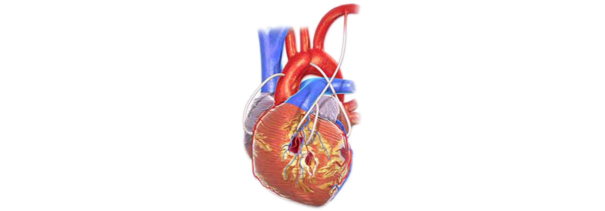 Quadruple Bypass Surgery Statistics Outcomes of Coronary Artery Bypass ...
